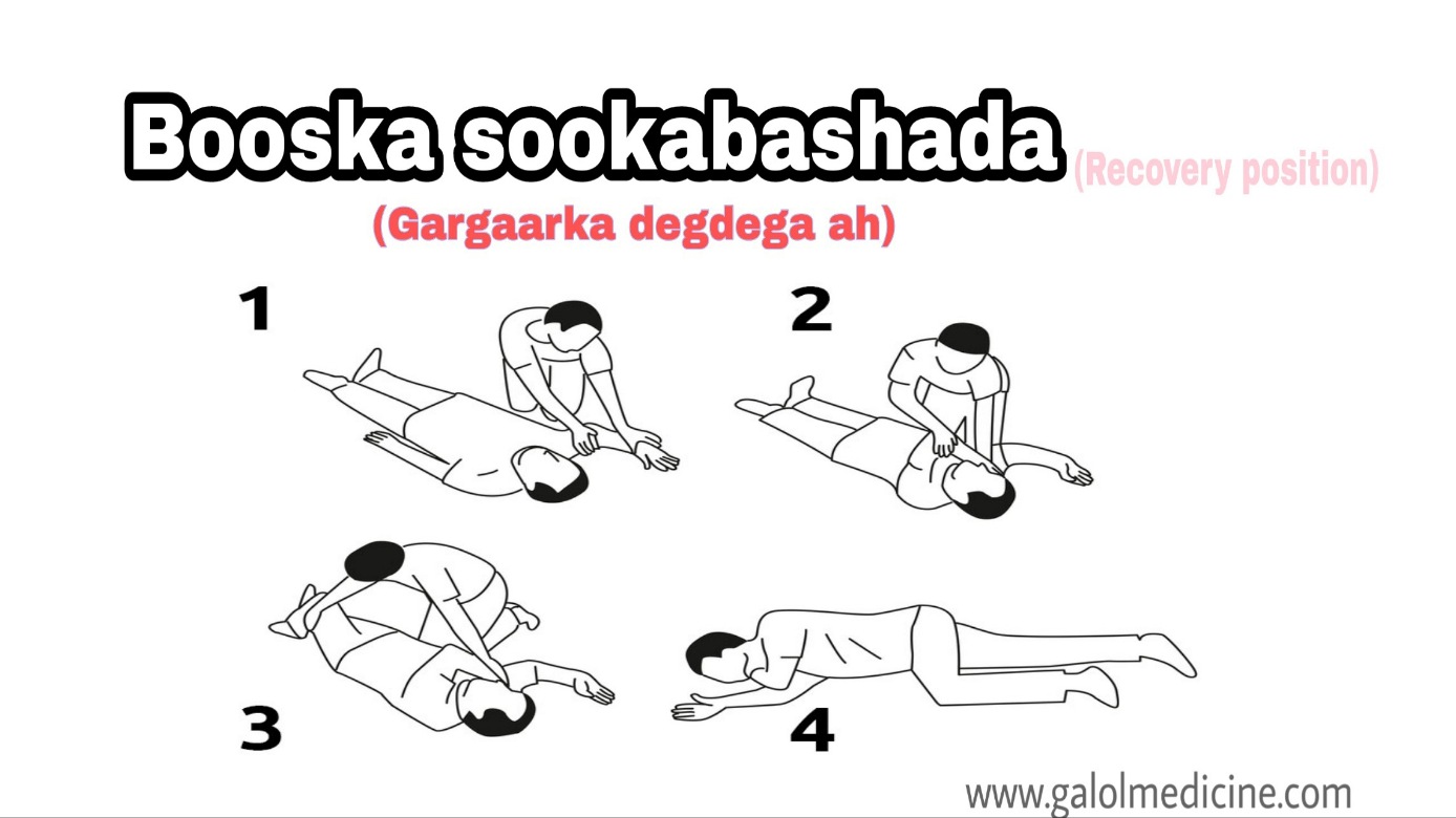 Booska Sokabashada | Galolmedicine