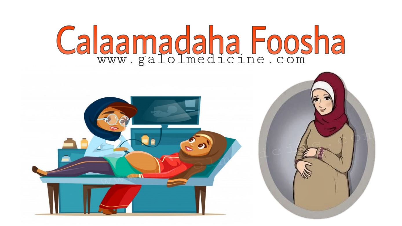 Calaamadaha Foosha(Signs of Labor) | Galolmedicine