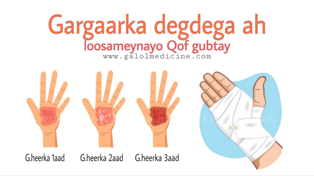 Gubashada: Gargaarka degdega ah | Galolmedicine