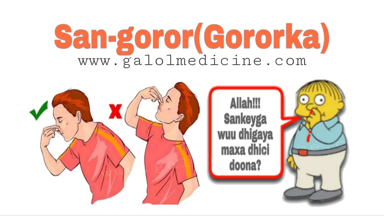 Sangoror(Gororka) | Galolmedicine