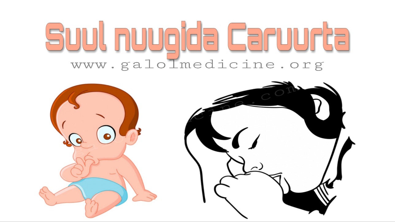 Caruurta Suulka Nuuga - Siden ugu joojiya? | Galolmedicine