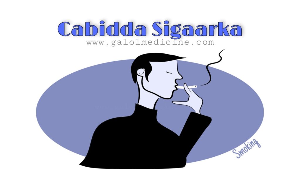 Cudurada Guud | Galolmedicine