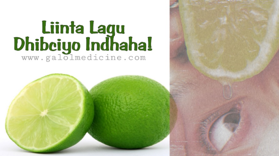 Liinta - indhaha malagu dhibcin kara? | Galolmedicine