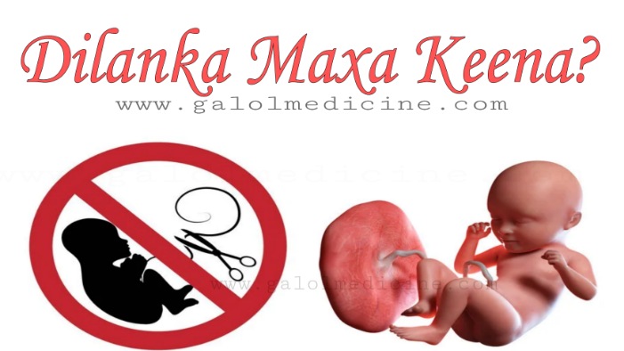 Dilanka Maxa Keena? | Galolmedicine